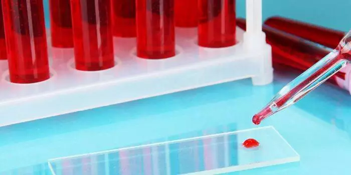 Pipetë dhe rënie gjaku në gotën e laboratorit