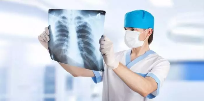 Mediķis skatās uz plaušu rentgenu