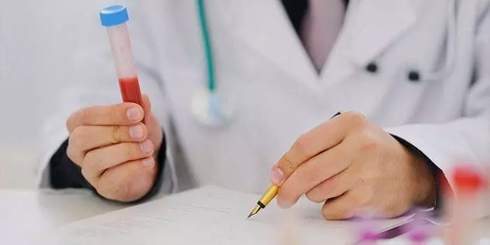 Lekár drží v ruke skúmavku s krvou a vypĺňa formulár