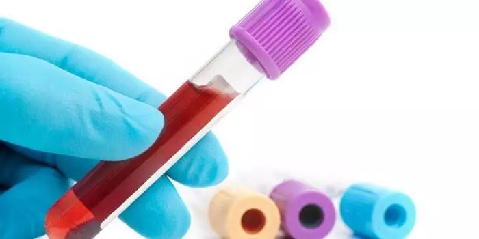 Krvný test in vitro