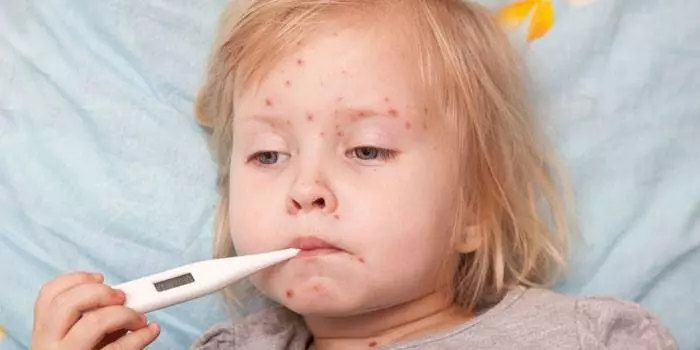 風疹の子供がベッドに横になり、口の中に体温計を持っています