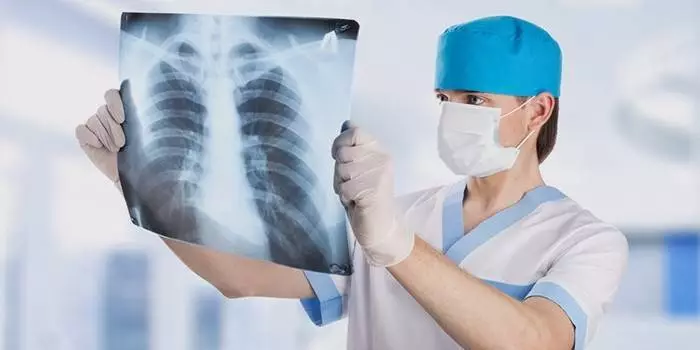 Bác sĩ kiểm tra phim chụp X-quang phổi