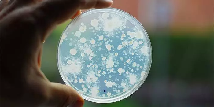 Čovjek drži Petrijevu zdjelicu s virusima
