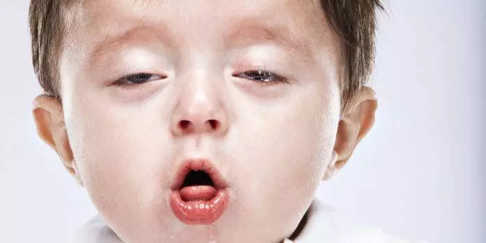 어린이의 심한 기침 : 질병의 원인 및 진단, 치료 방법