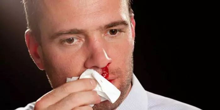 Pendarahan hidung pada pria