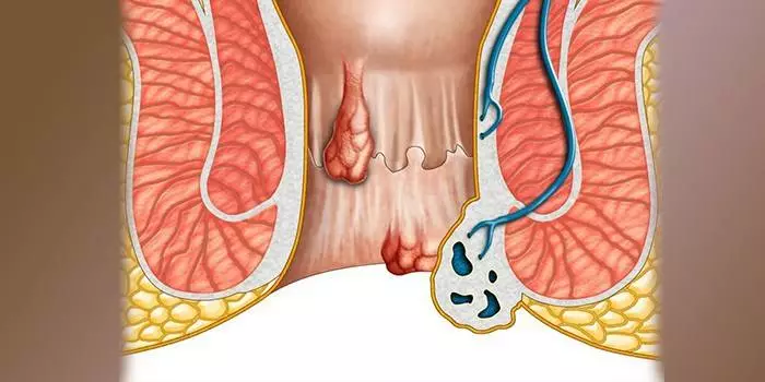 අර්ශස් වර්ධන යෝජනා ක්‍රමය