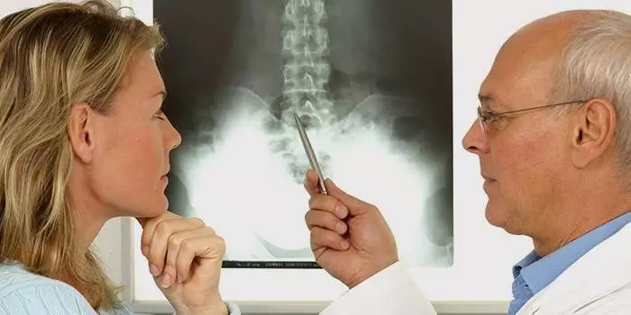 Amb una hèrnia de la columna vertebral a la radiografia