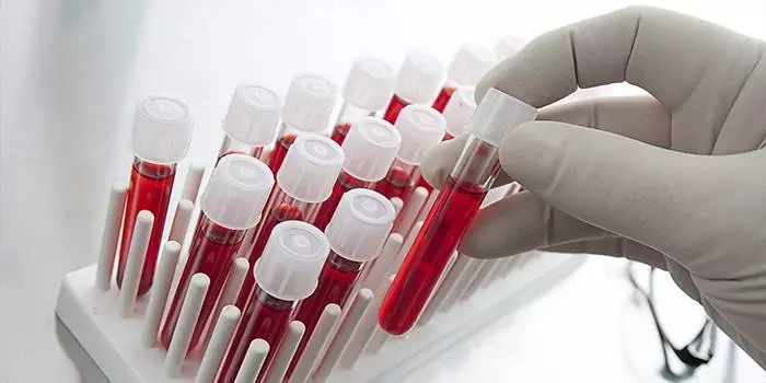 Tubes à essai sanguin pour analyse