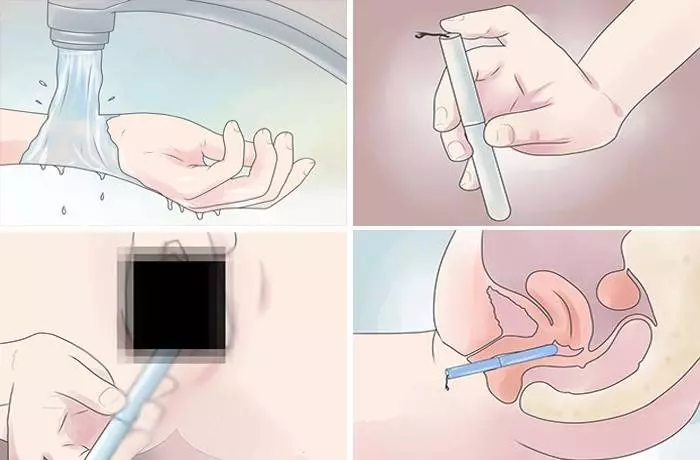 Cara memasukkan tampon dengan benar