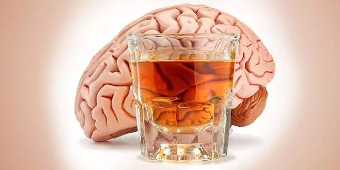 ადამიანის ტვინი და ჭიქა ალკოჰოლი