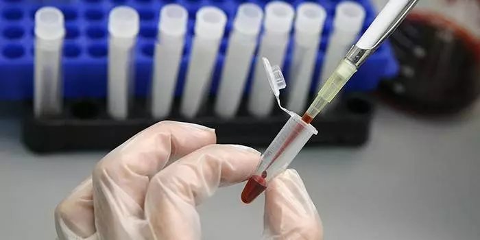 O médico realiza unha análise de sangue