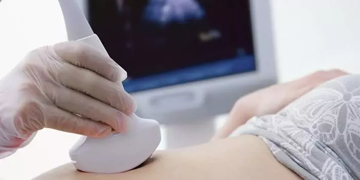 uchunguzi wa ultrasound