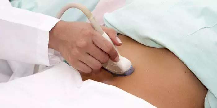 Ultrasound ea litho tsa pelvic