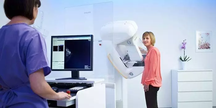 Mammography nke dijitalụ