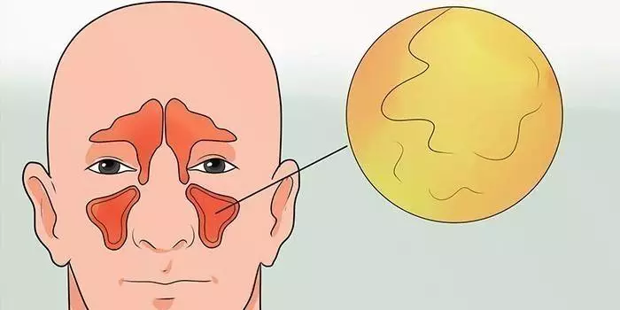 De lokaasje fan de maxillary sinussen