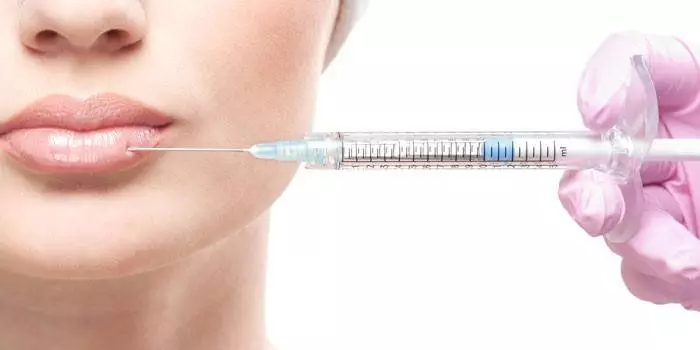 Người phụ nữ tiêm botox vào môi