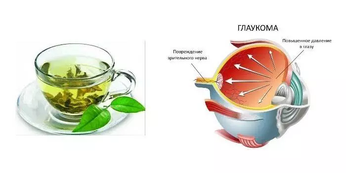 Una tazza di tè verde e glaucoma