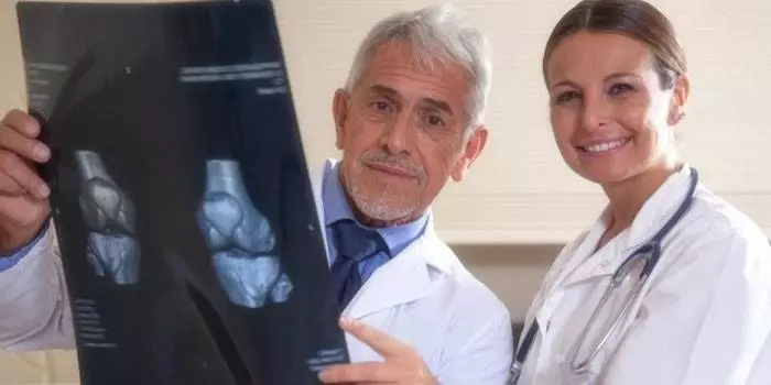 I medici esaminano una radiografia delle articolazioni