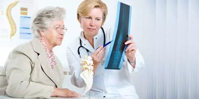 Doktor ukazující rentgen staršímu pacientovi