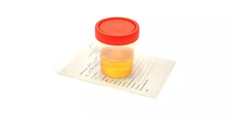 Analisis urin