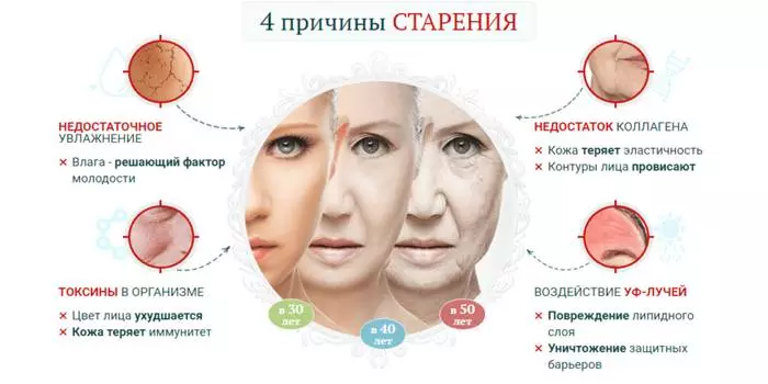 肌の老化の4つの原因