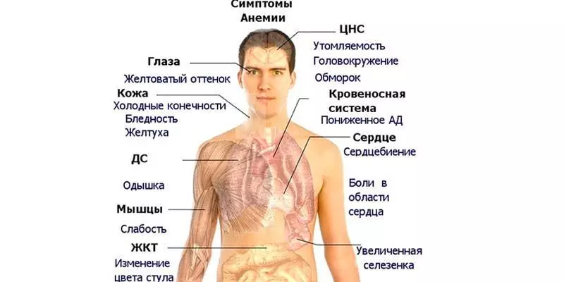 သွေးအားနည်းရောဂါလက္ခဏာများ