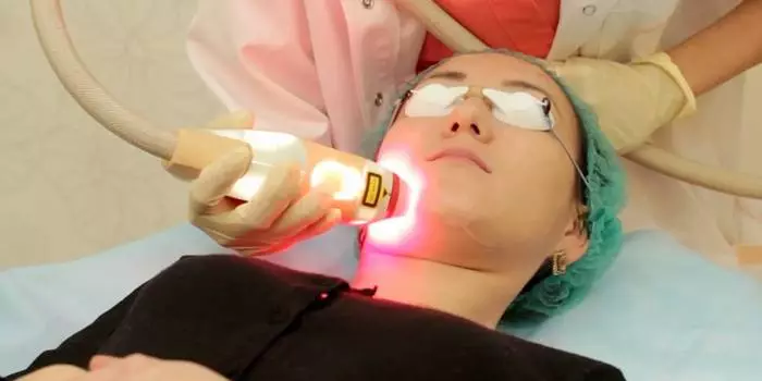 Điều trị bằng laser