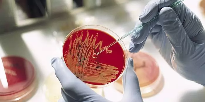 Bakteriologiese kultuur in 'n petriskottel