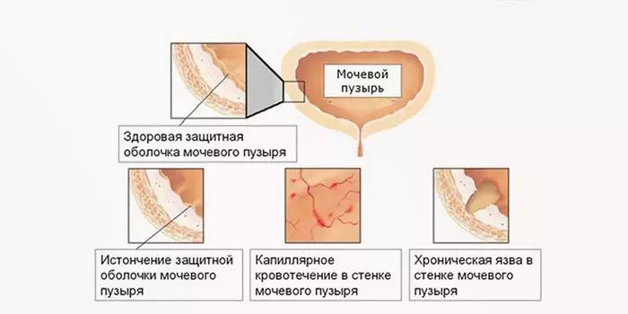 କ୍ରନିକ୍