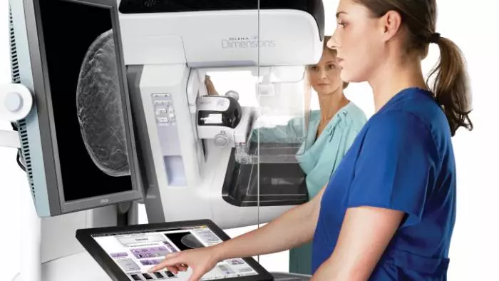 Digitālā mamogrāfija