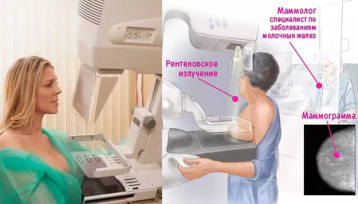 Mamografiya