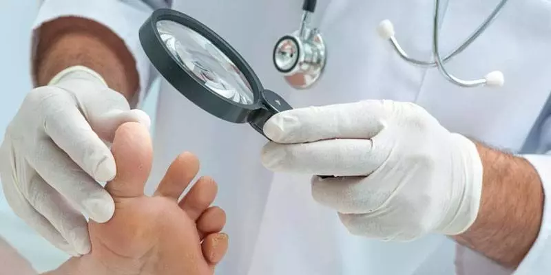 დერმატოლოგი იკვლევს პაციენტის ფეხს