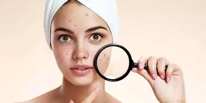 Acne talker: aplicație și recenzii