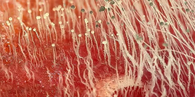 Fungus in the body