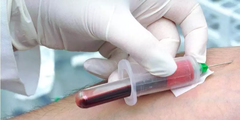 Análise de sangue para detectar infeccións fúngicas