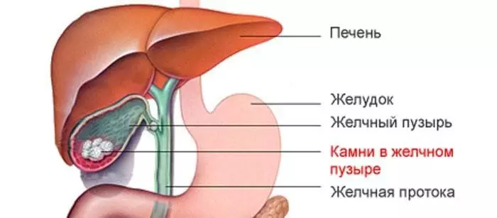 Diet kanggo penyakit empedu - jatah menu sajrone seminggu, resep karo foto lan video