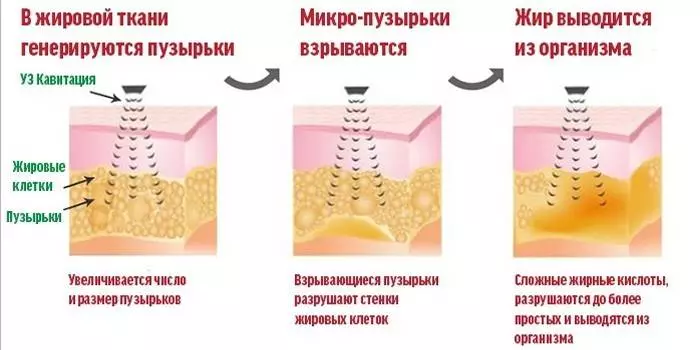 Principle of the Cavitation procedure