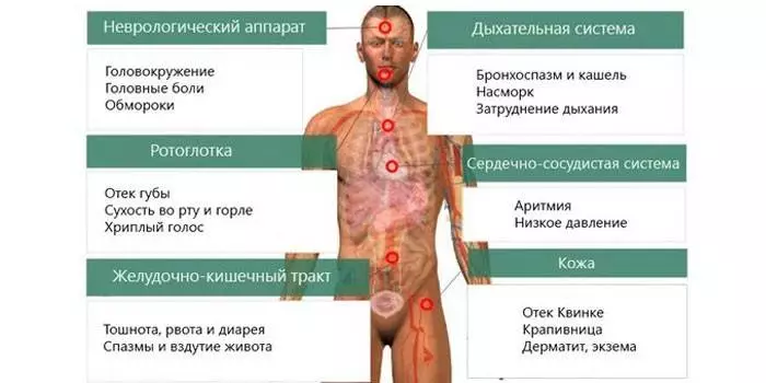 Аллергиянын белгилери