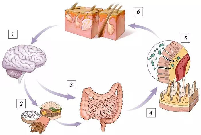 Efectos das toxinas na pel