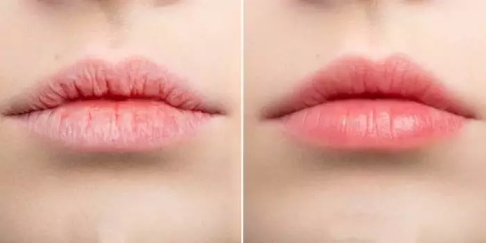 Lippen vor und nach dem Auftragen des Balsams