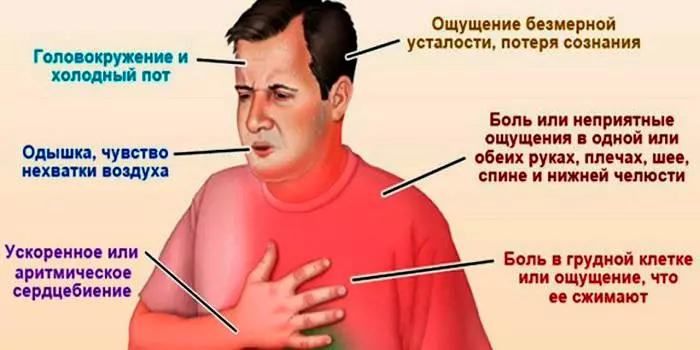 နှလုံးတိုက်ခိုက်မှု၏လက္ခဏာများ
