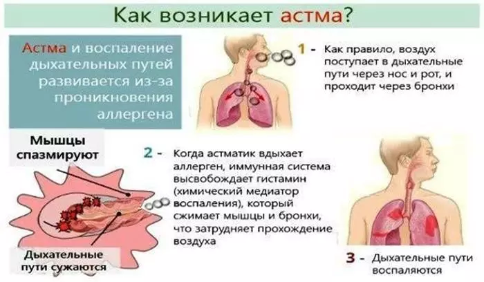 Астма кантип пайда болот