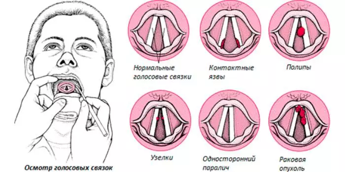 Stimulaasjepatologyen