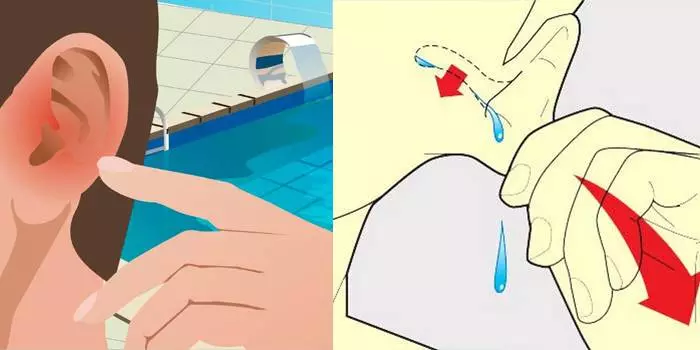 How to get rid of water in your ear