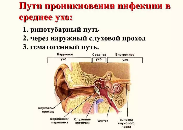 Routes of infection in the middle ear