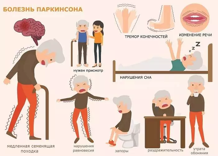 Parkinson gaixotasunaren sintomak