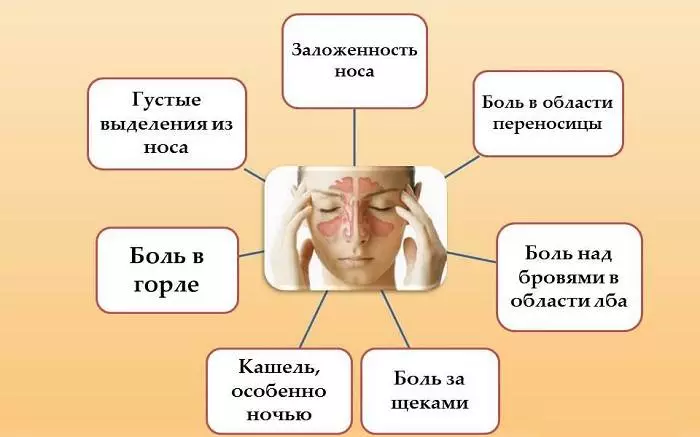 симптоми синуситу