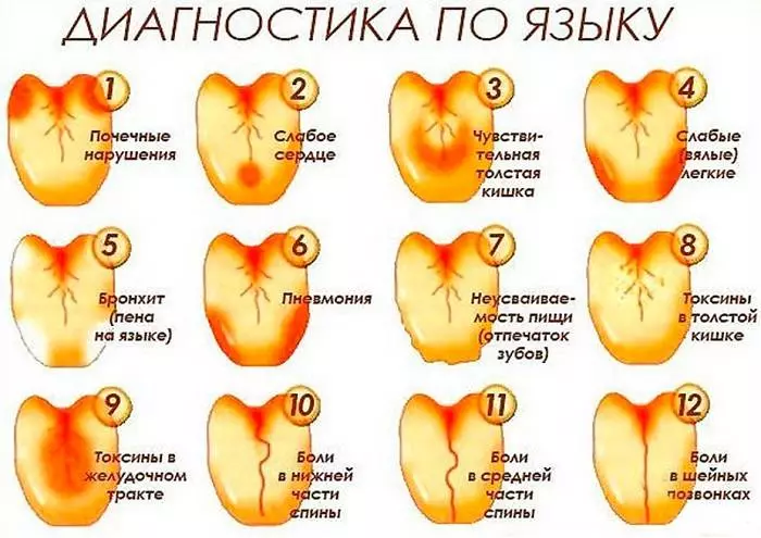 Диагностика аз рӯи забон