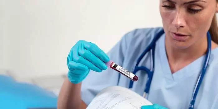 Лабораторът изследва кръвен тест