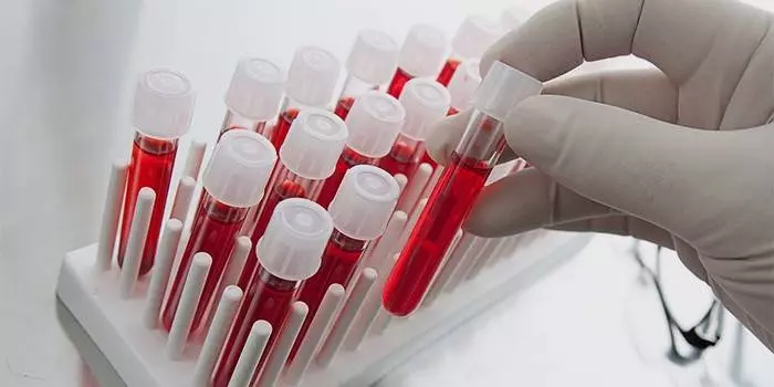 Laboratorijski sodelavec opravi krvni test za trombocite
